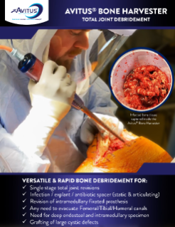 Avitus® Bone Debrider